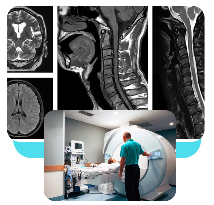 ام آر آی - مرکز دکتر قادسی