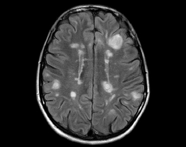 تصویر برداری سونوگرافی - مرکز دکتر قادسی